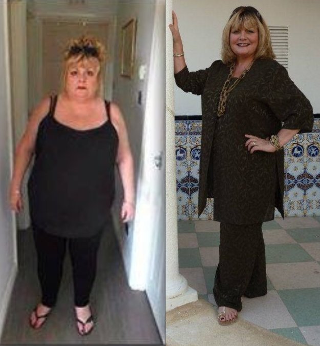 [INTERVIEW] Anne drops 6 stone and gains a new lease on life* | VLCD ...