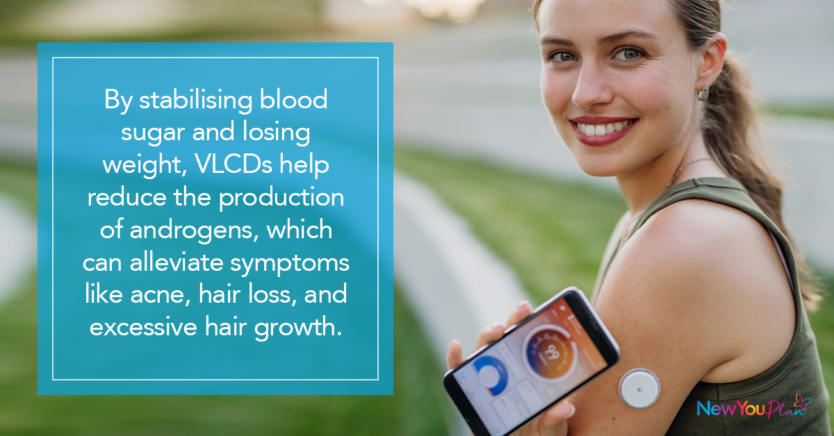 How The New You Plan VLCD Can Help Improve PCOS Symptoms - The New You Plan